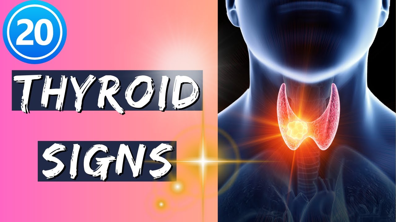 Your Thyroid is in Trouble (20 Early Warning Signs ) - YouTube