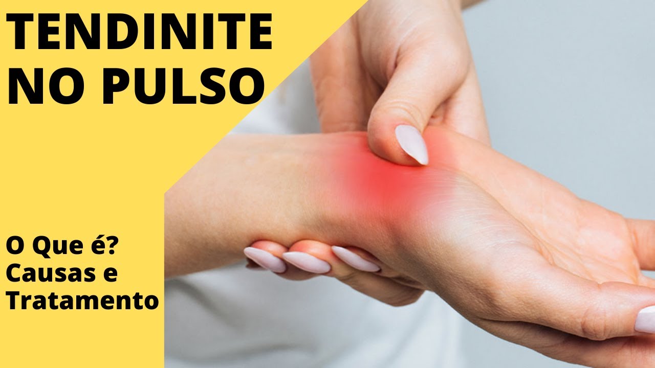 Tendinite no pulso O Que é Causas e Tratamento - YouTube