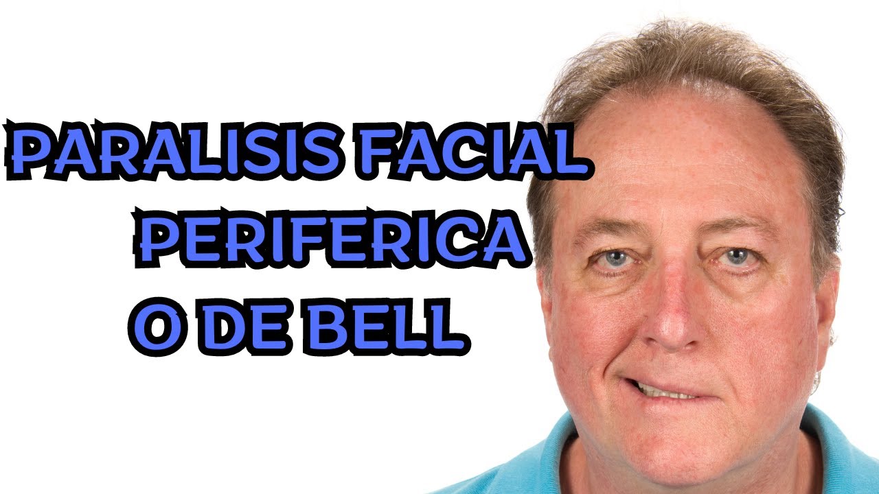 PARALISIS FACIAL PERIFERICA o PARALISIS DE BELL. Causas, síntomas, y ...