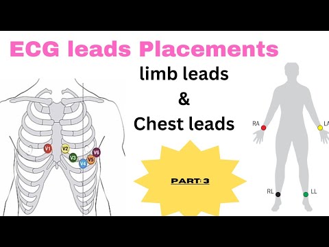 12 Leads ECG Placement , Made Easy || Limb Leads and Chest Leads ...