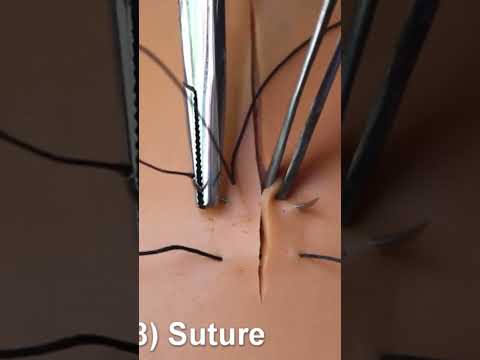 188.Figure of 8 suture #technique of suturing #dental procedure  #dentist #surgeryeducation #stitch