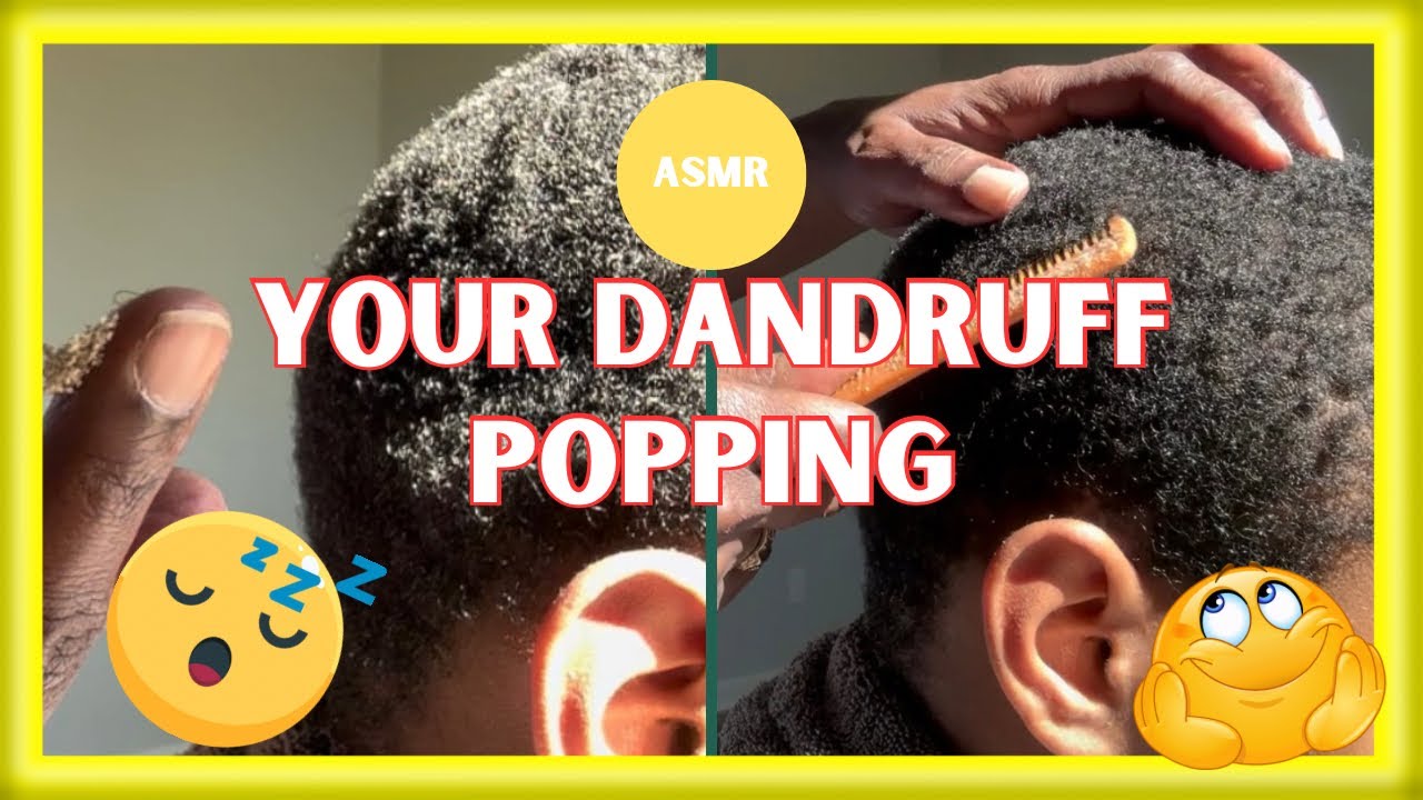 DANDRUFF REMOVAL ASMR #asmr #satisfying #relaxing #naturalhair - YouTube
