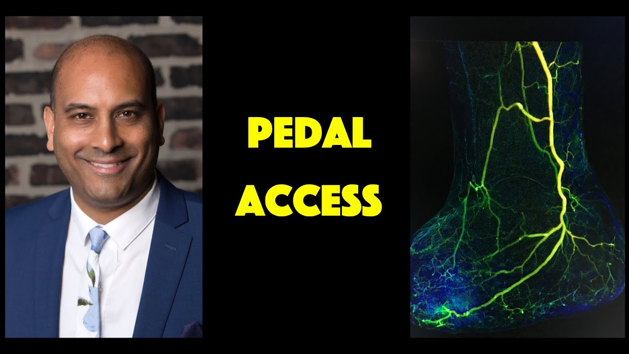 Let's Talk Pedal Access! - YouTube