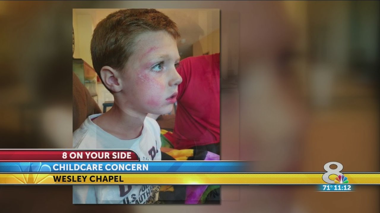 Parents share shocking pictures, say injuries are from child's ...