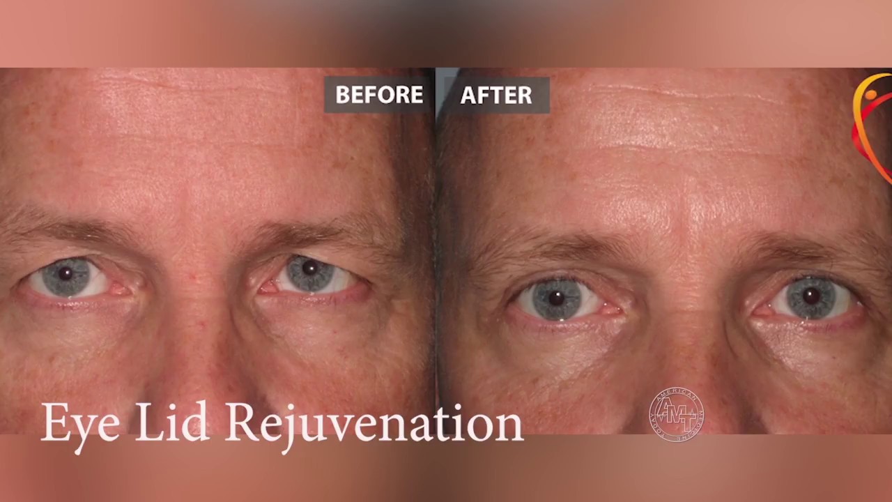 American Medicine Today - Deepak Naidu Cosmetic Surgeon - YouTube