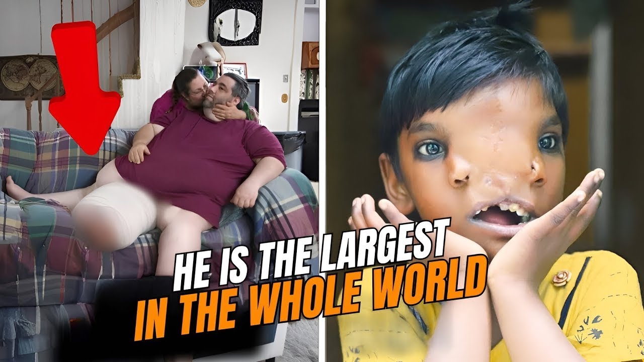 VERY HUGE‼️ THESE ARE 10 UNIQUE PEOPLE WHO HAVE THE LARGEST BODY PARTS ...