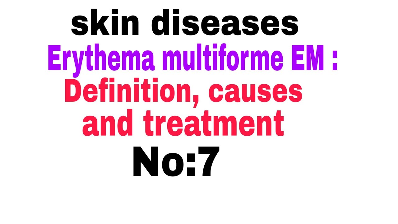 Erythema multiforme EM. Skin diseases - YouTube