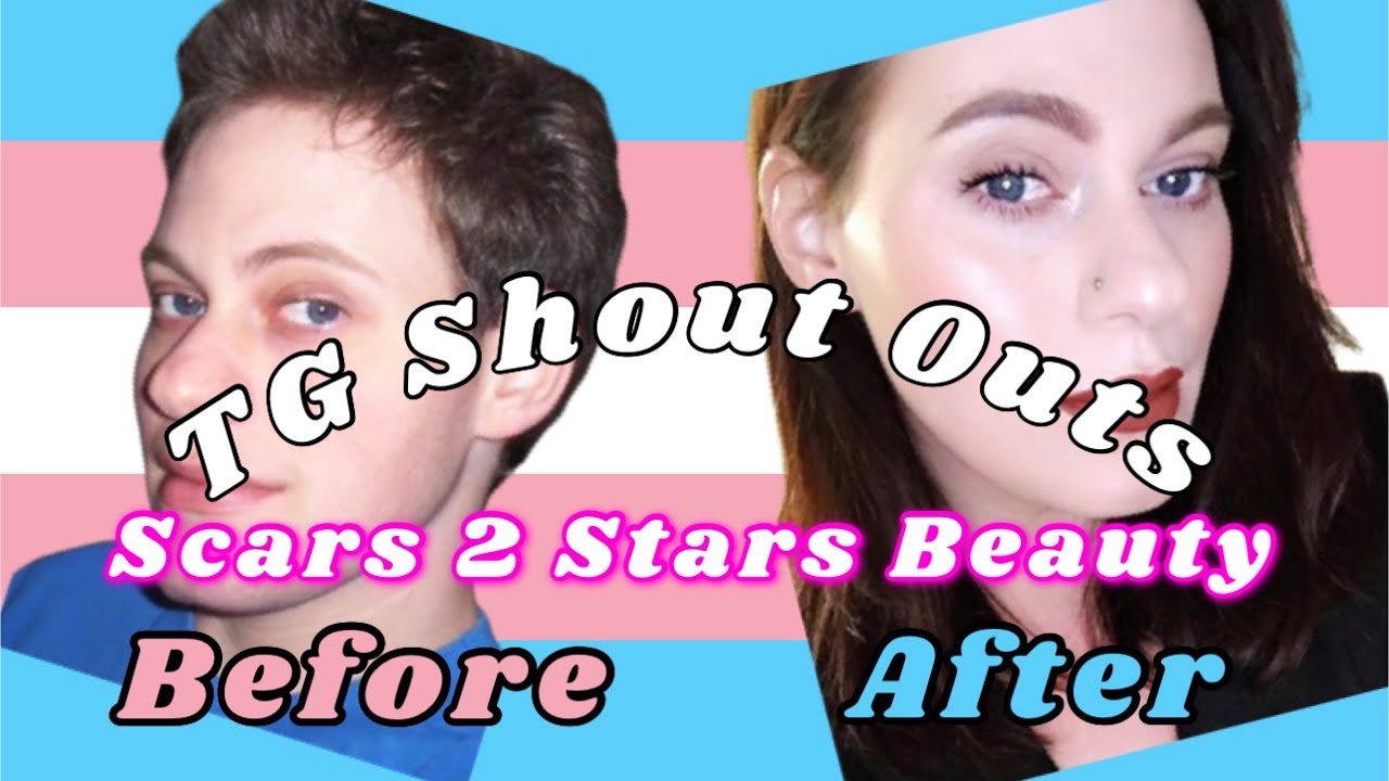 Transgender Shout Outs #0017 🏳️‍⚧️ Scars 2 Stars Beauty HRT Male To ...
