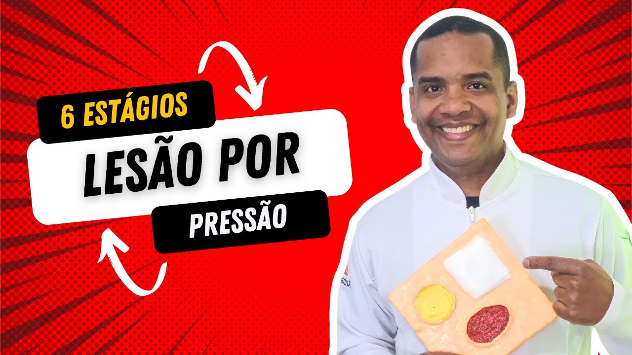 DESCUBRA OS ESTÁGIOS DA LESÃO POR PRESSÃO- SEU MAPA PARA TRATAR LPP ...