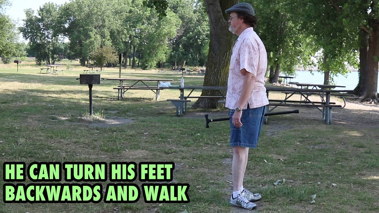 Backwards Feet Man Can Make His Feet Turn Backwards And Walk - YouTube