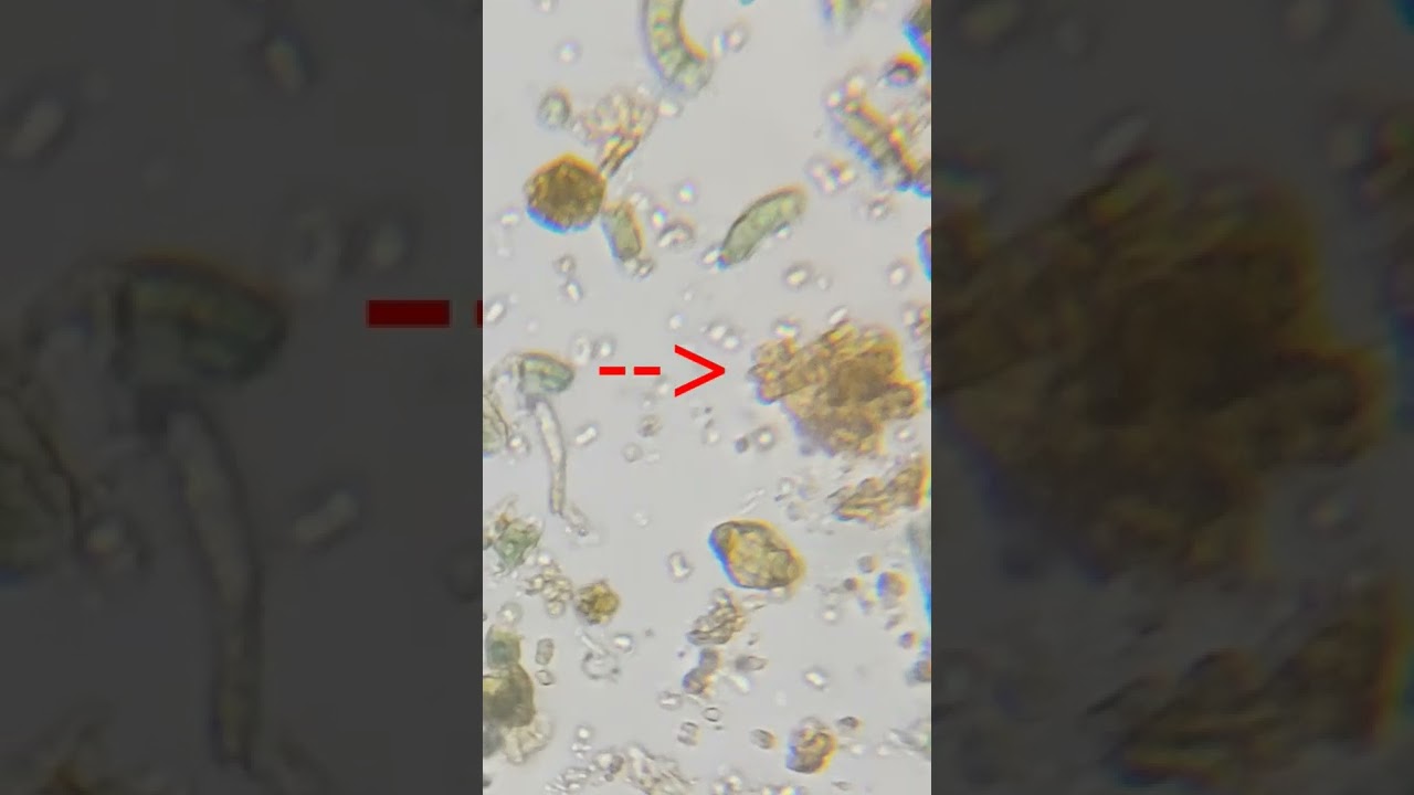 Kombucha Under A Microscope #microscope #kombuchatea - YouTube