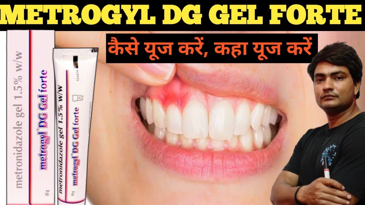 metrogyl dg gel forte, metrogyl dg gel forte uses in hindi, metrogyl dg ...
