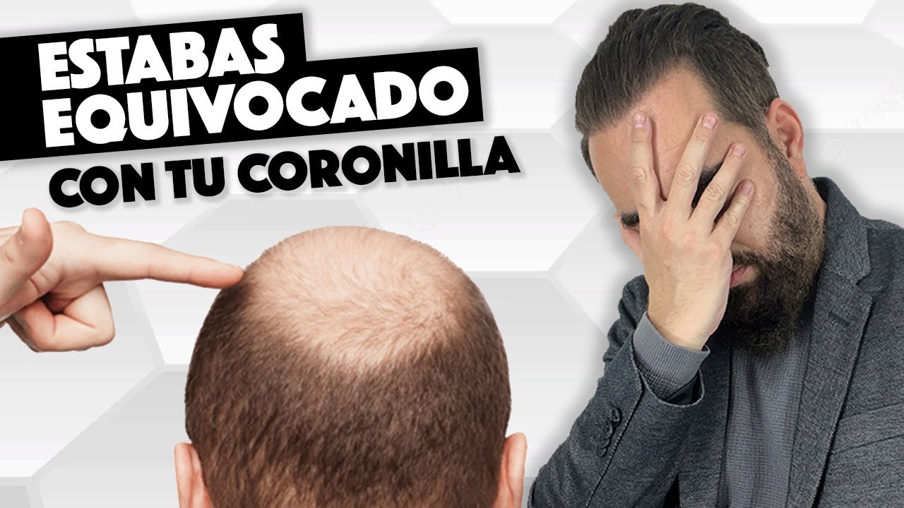 Estabas equivocado sobre la Evolución de la coronilla de tu trasplante ...