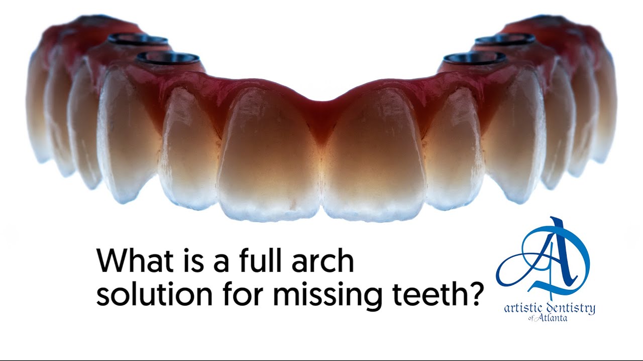 There is a Solution for Uncomfortable Dentures - Your Full Arch Options ...