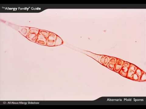 All About Allergy Slideshow - Alternaria Mold Spores, 13 of 29 - YouTube