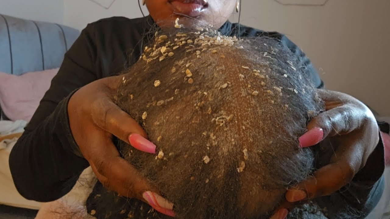 ASMR this will make you sleepy 😴 Best hair scalp scratching, head ...