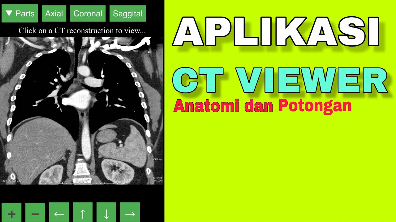 Aplikasi CT scan view //bisa untuk belajar anatomi dari hasil CT scan ...