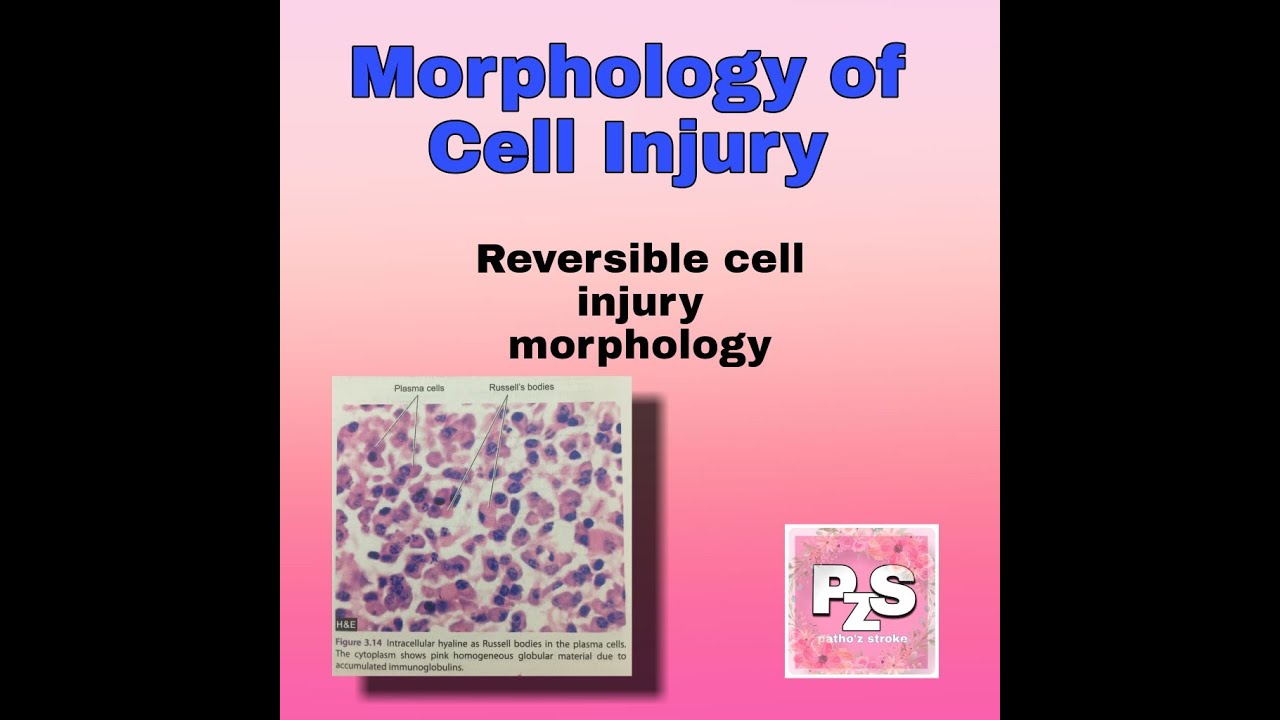 Morphology of Cell Injury( reversible type) - YouTube