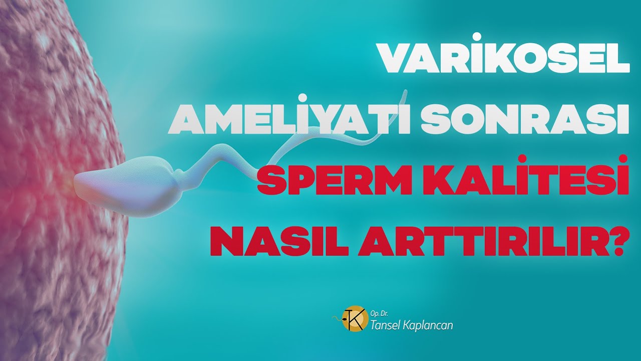 Varikosel Ameliyatı Sonrası Sperm Kalitesi Nasıl Arttırılır? - YouTube