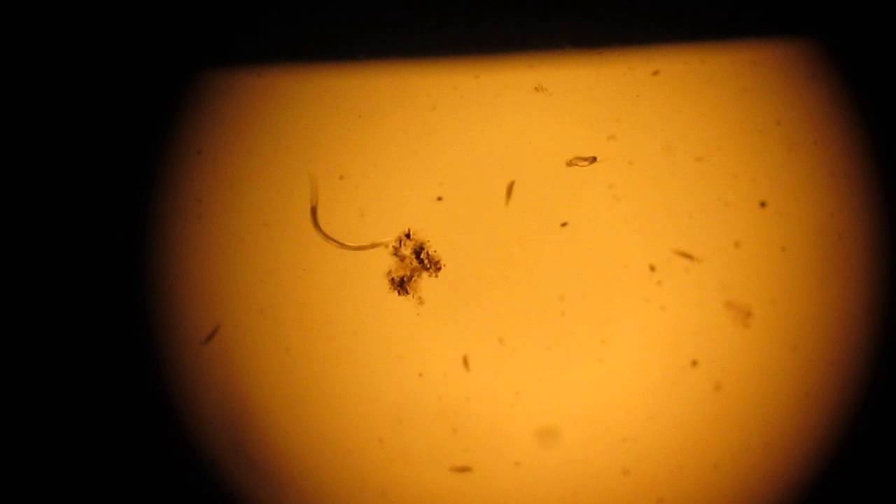 nematode moving - YouTube