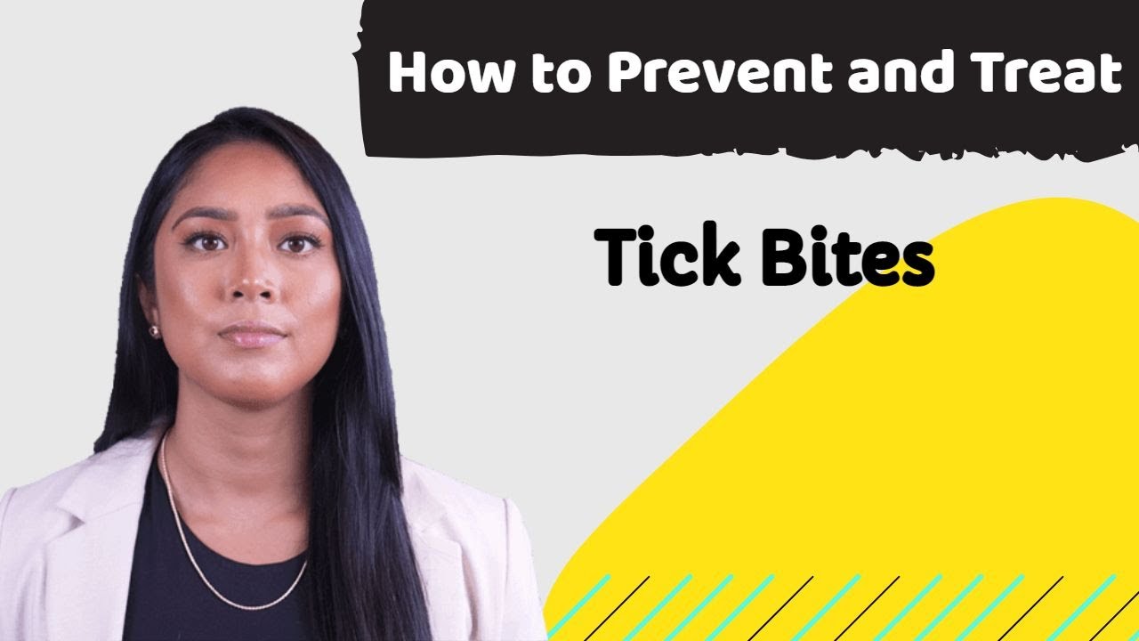 Tick Infestation in Dogs: How to Prevent and Treat Tick Bites - YouTube