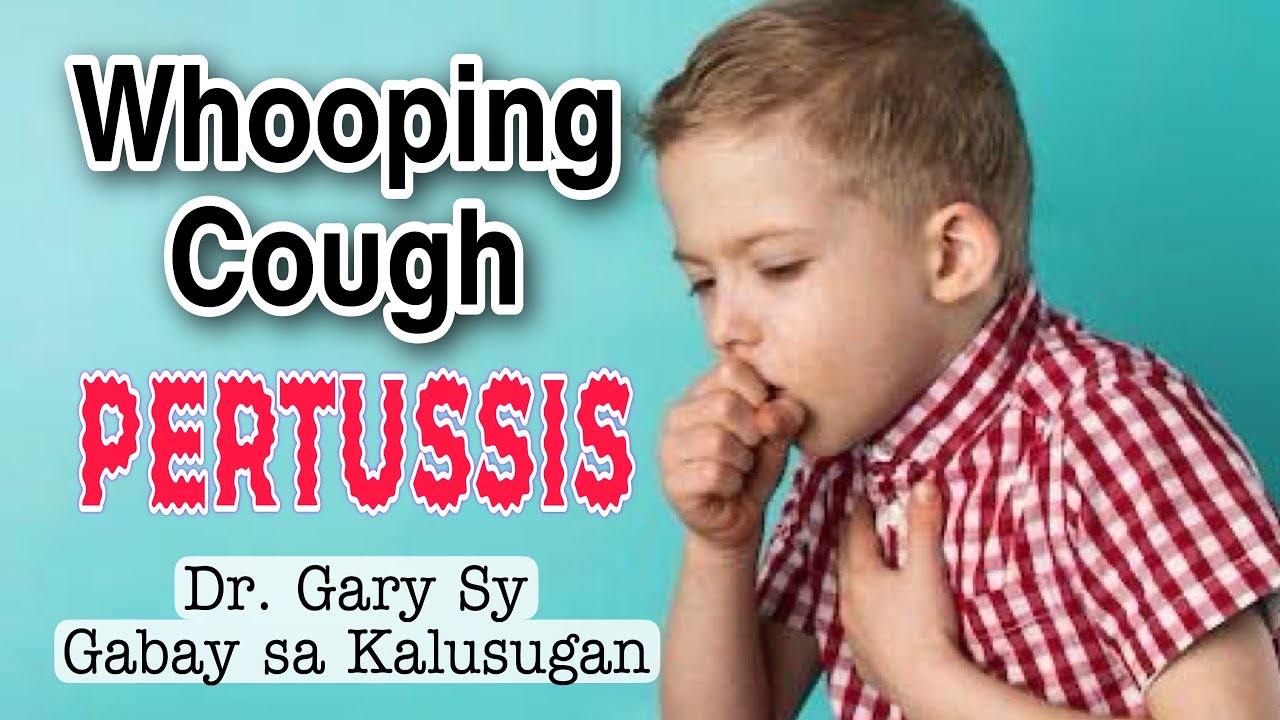Whooping Cough (Pertussis): Causes, Symptoms & Treatment - Dr. Gary Sy ...