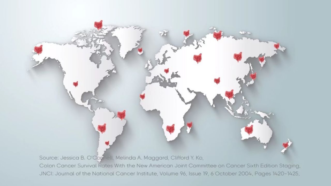 Wouldn’t it be better if we could detect colorectal cancer early? | BGI ...