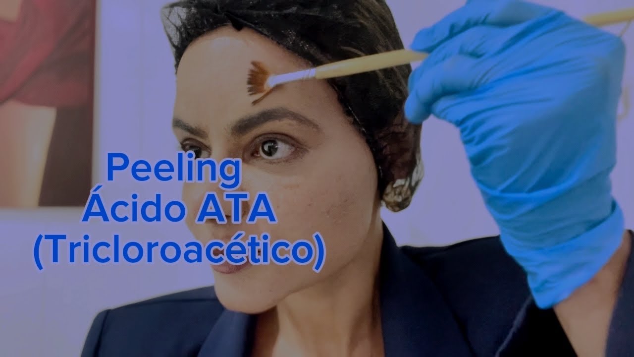 PEELING ÁCIDO ATA| Fazendo e explicando - YouTube