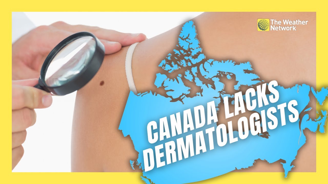 Skin Cancers May Be Going Undiagnosed in Canada Due to Few ...