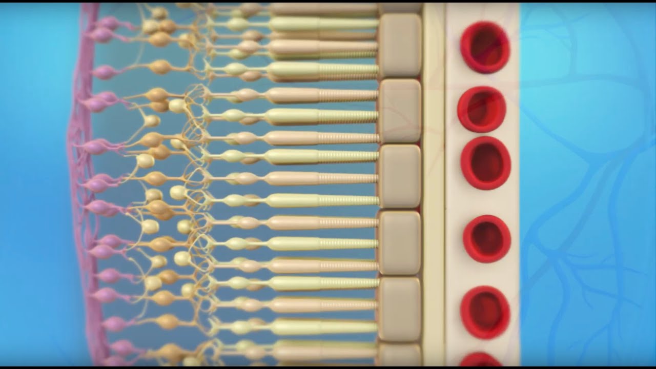 Retina DMAE Húmeda Inyección - YouTube