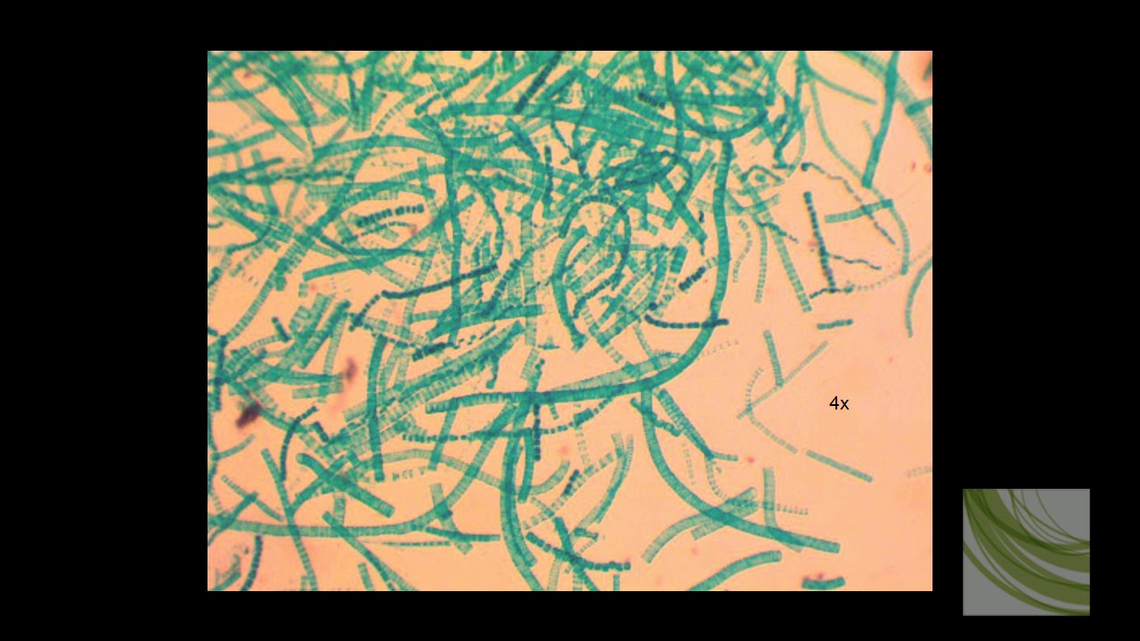 ORGANISM SLIDE: Ulothrix - YouTube