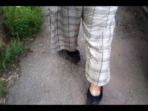 Man with short left leg 5 - YouTube