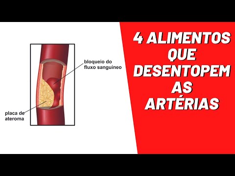 4 alimentos maravilhosos que desentopem as artérias! | Dr. Marco Menelau