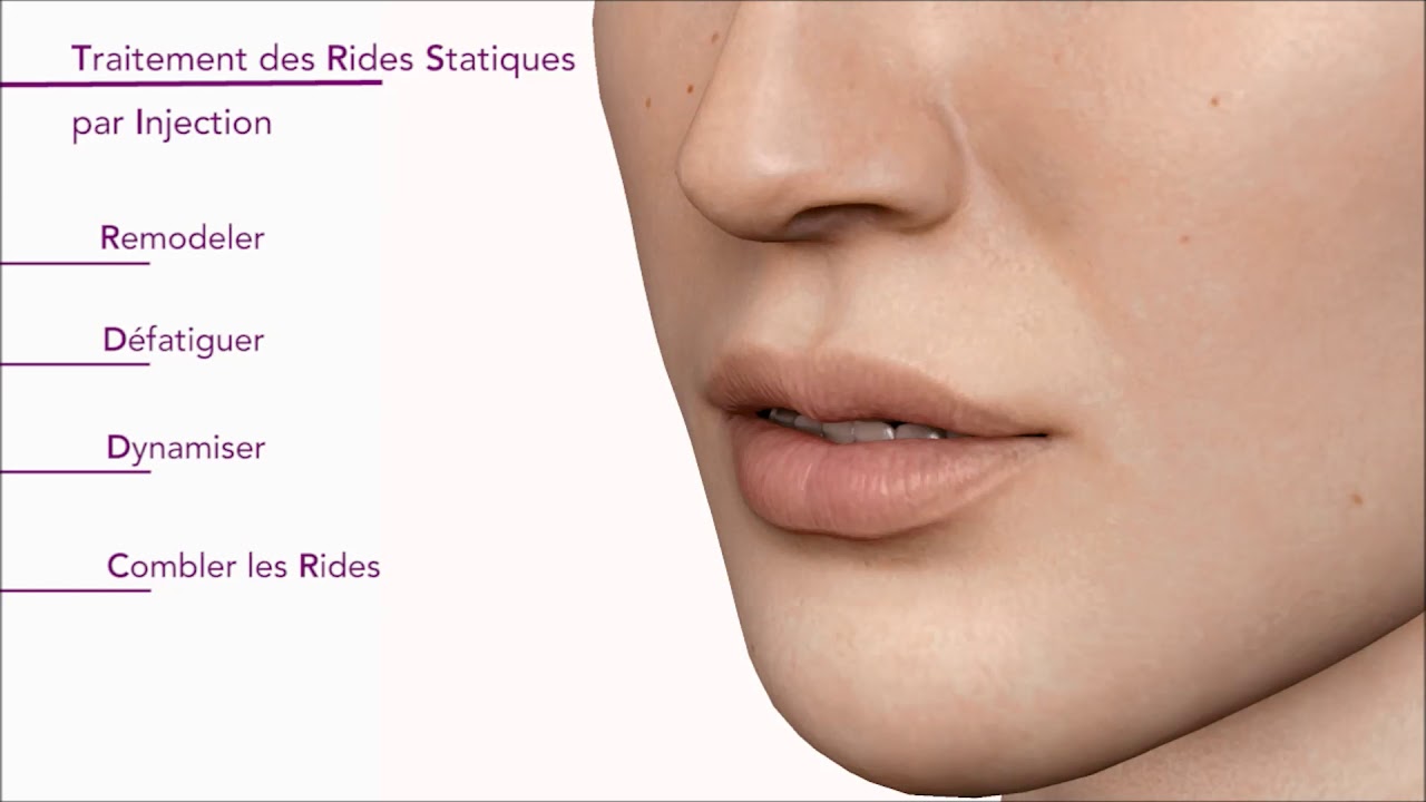 injection acide hyaluronique sillons nasogéniens à montpellier | Dr ...
