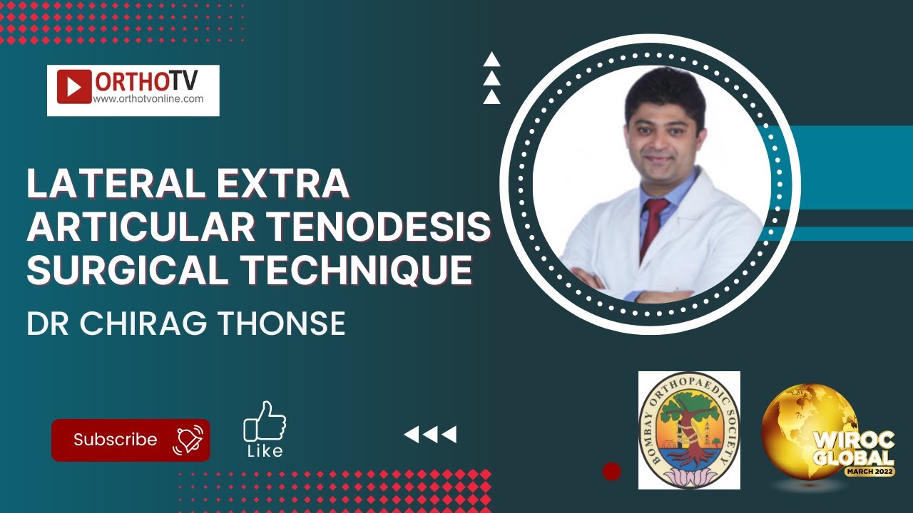 Lateral Extra Articular Tenodesis surgical Technique - Dr Chirag Thonse ...