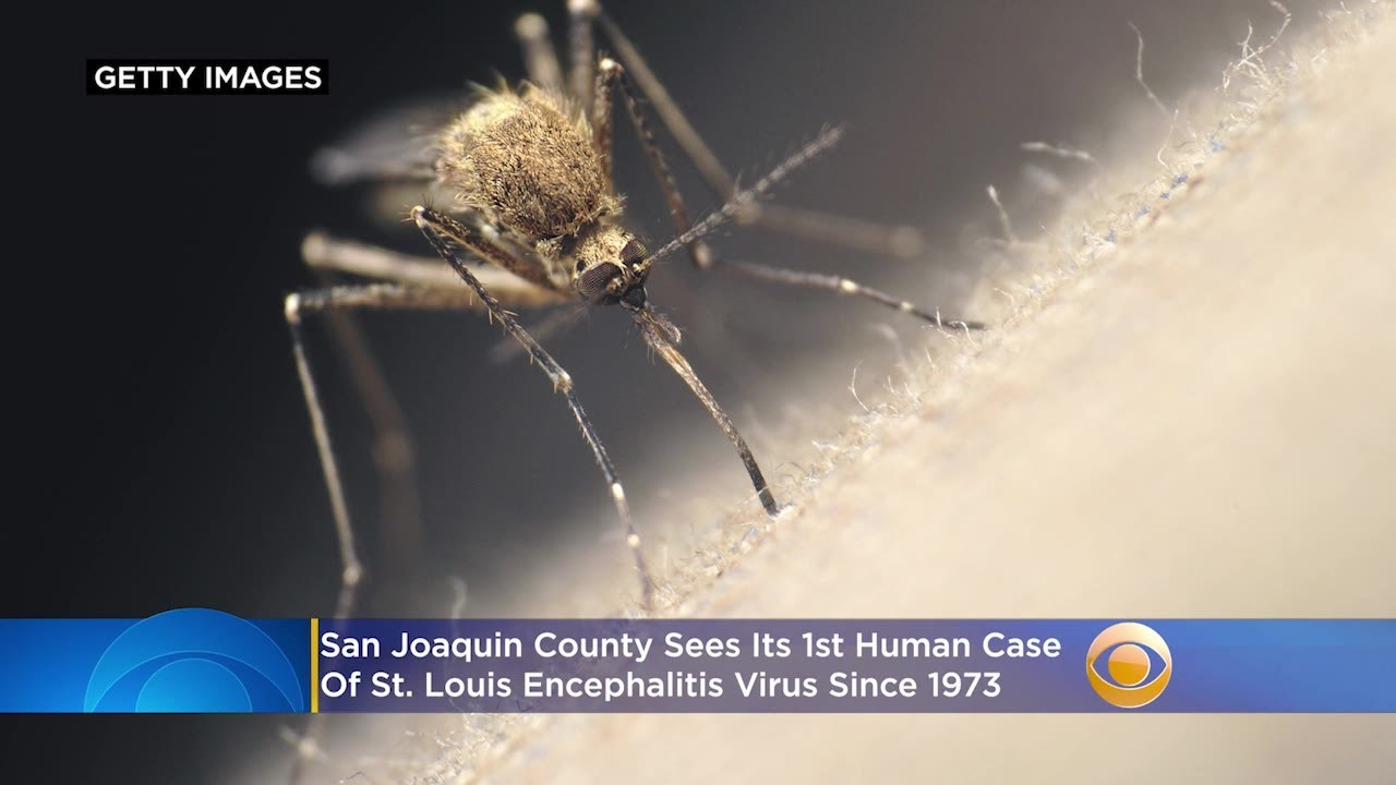 San Joaquin County Sees Its 1st Human Case Of St. Louis Encephalitis ...