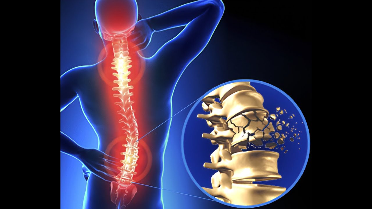 Determination of Foley`S Bulb for Cervical Ripening in Induction of ...