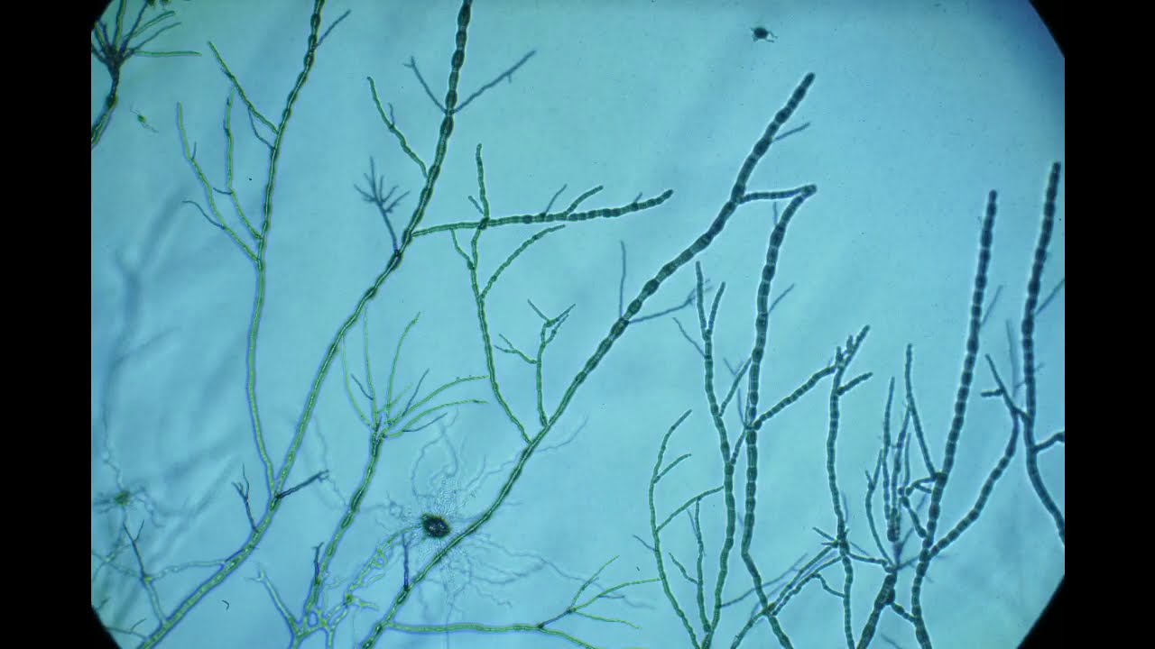 Growth of fungal mycelium (1125x speed, Neurospora crassa) - YouTube