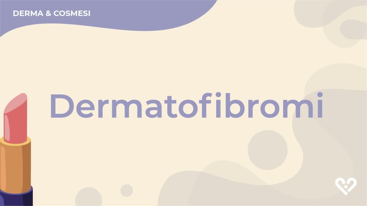 Dermatofibromi: cos'è, come si presenta e come si cura - YouTube