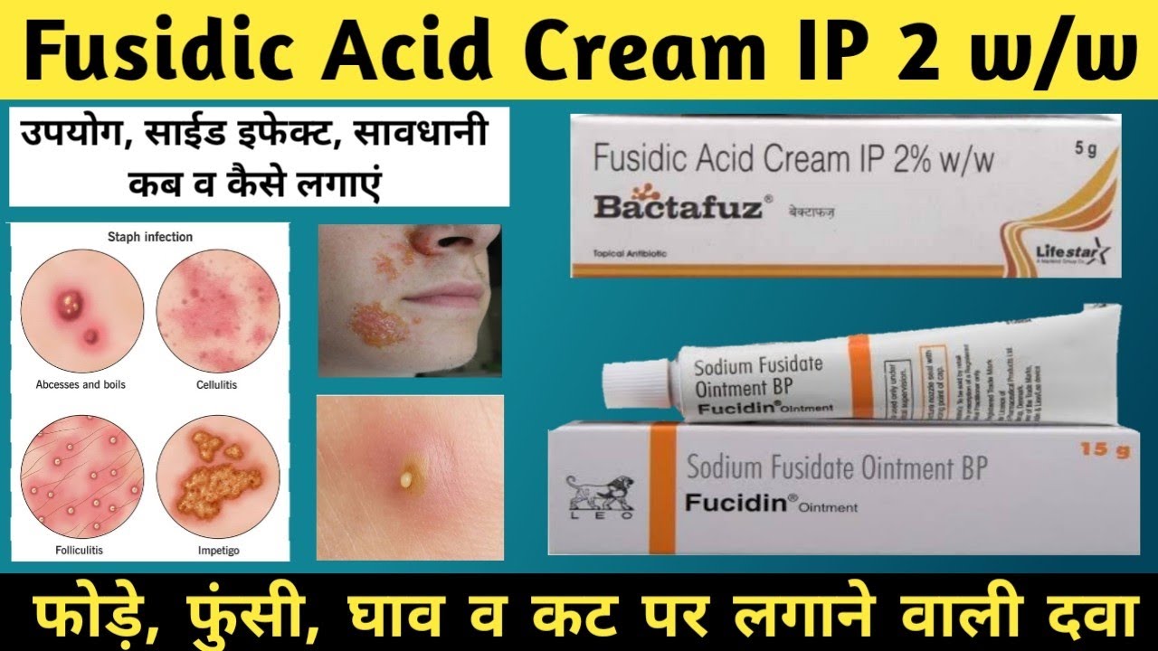 Fusidic Acid Cream IP | fucidin cream review | Fusiderm Cream | Fusidic ...