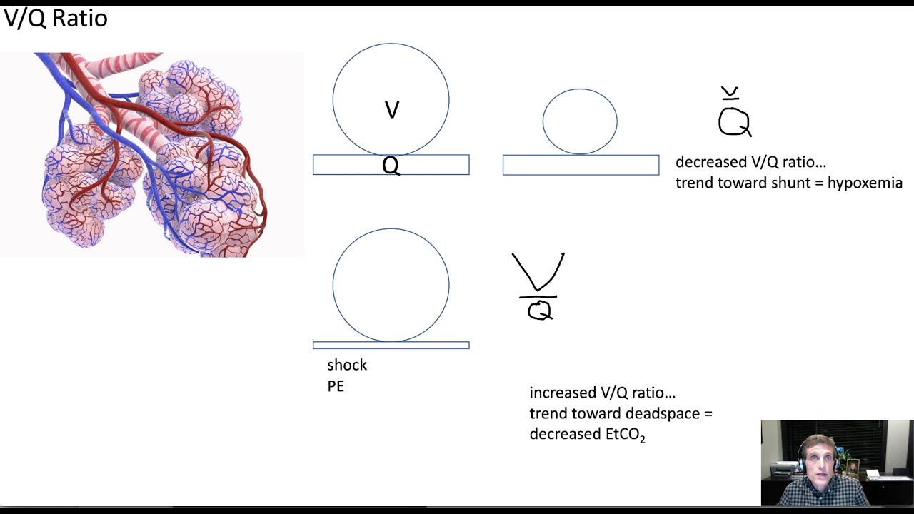 EtCO2 should be the 6th vital sign - YouTube