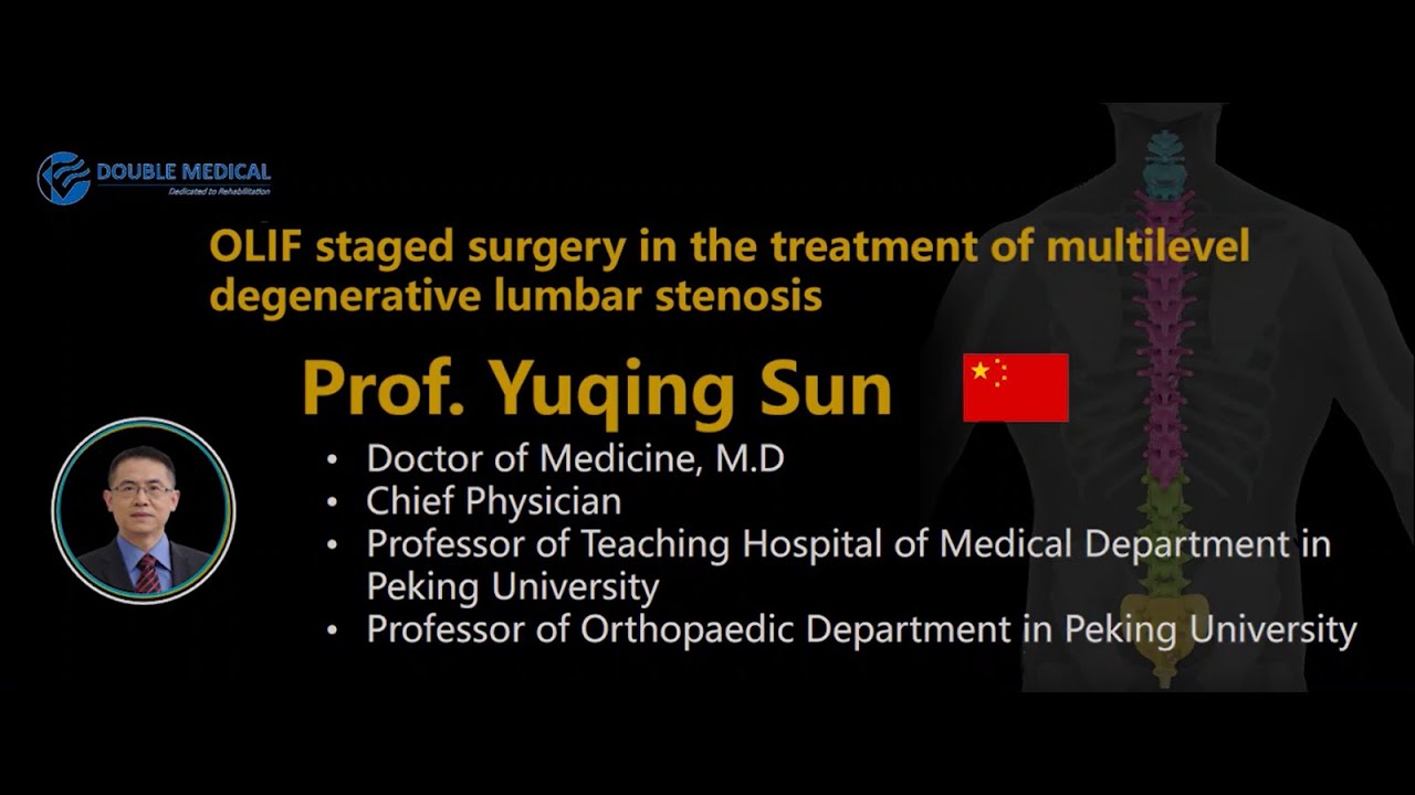 Double Medical Group Spine Webinar-Prof. Yuqing Sun - YouTube