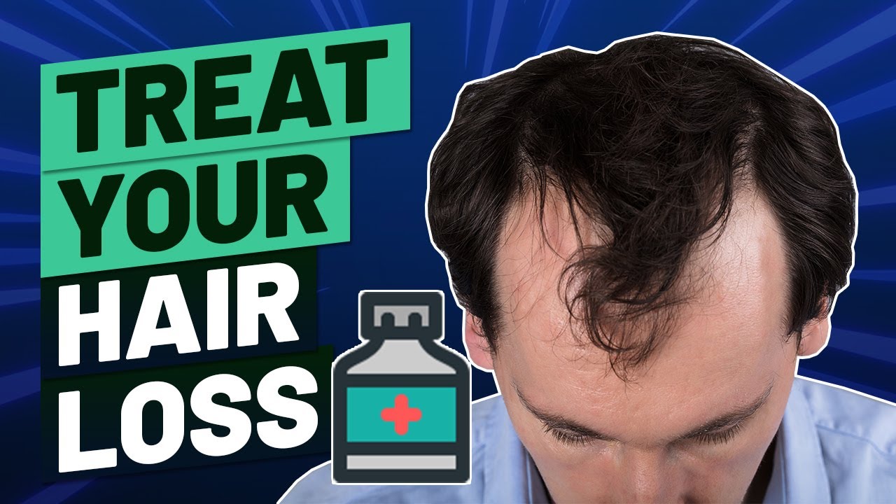 Balding Temples and Receding Hairlines: How To Treat It - YouTube