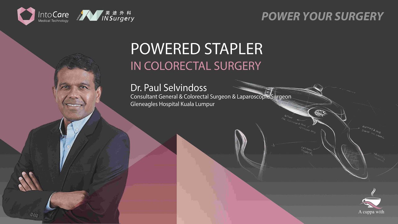 Powered Stapler in Colorectal Surgery - YouTube