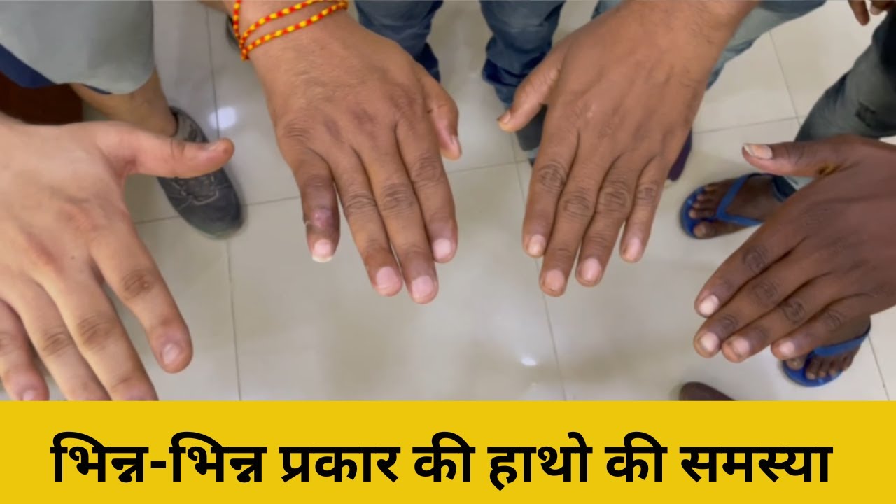 हाथो की समस्या से हैं परेशान डॉ अमित मित्तल से जानिए समाधान | Complete Hand Solution - YouTube