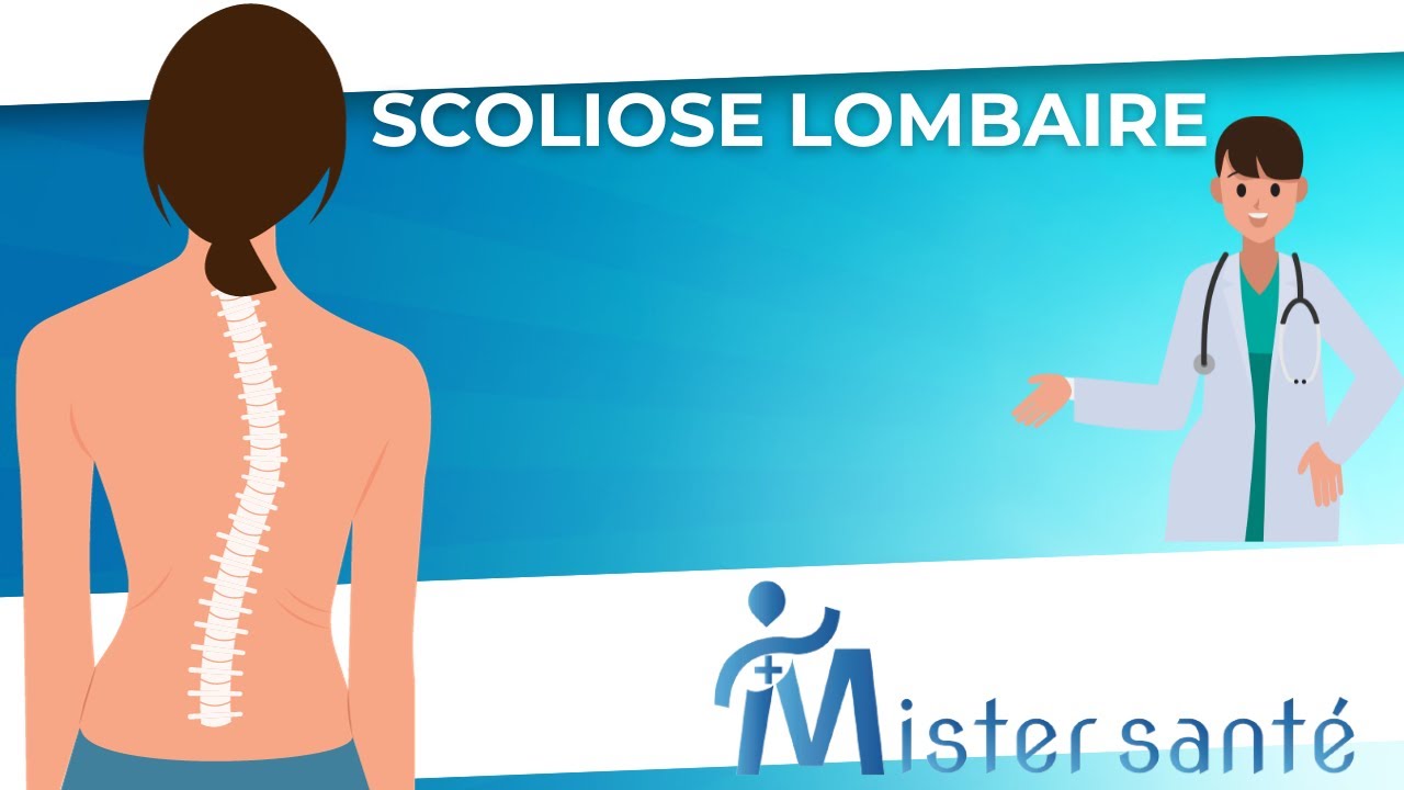scoliose lombaire, causes, symptômes et traitements - YouTube