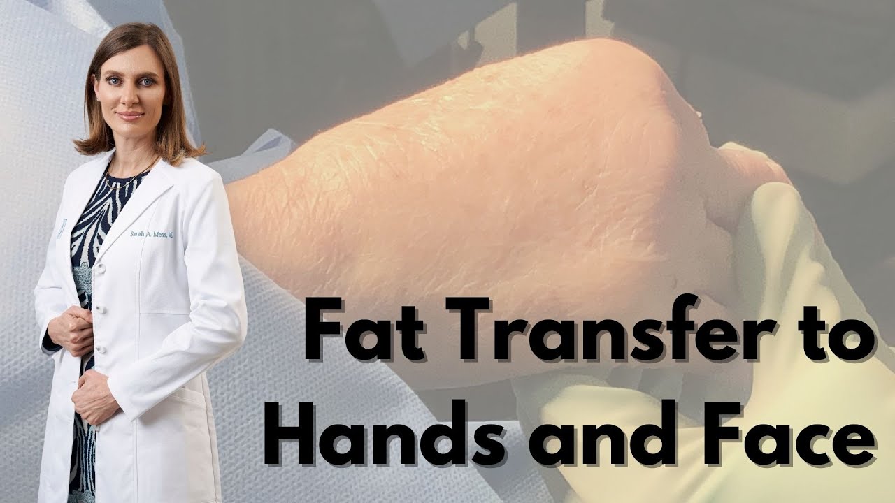 Fat Transfer to Hand and Face | Dr. Sarah Mess - YouTube