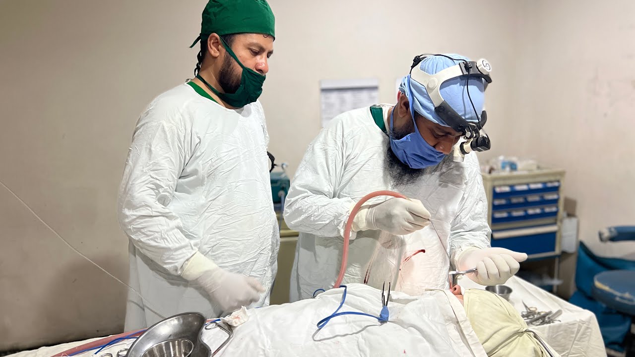 নাকের ভিতর থেকে পাথর অপসারন।Rhinolith removal under General anaesthesia ...