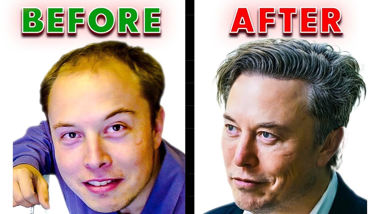 Elon Musk's Hair Transformation: What Surgeons Don't Want You to Know ...