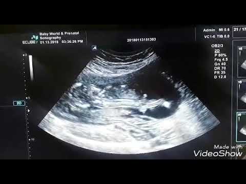 Baby boy 13 weeks - YouTube